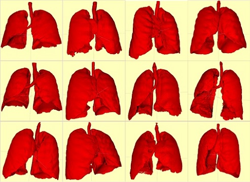 Lungs Image Processing and Computer Vision in Pulmonology