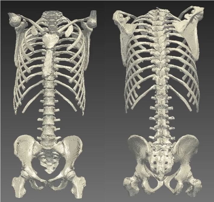 Computer Vision and AI for Orthopedic Surgery by RSIP Vision