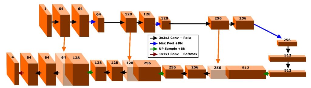 3D Cardiac MRI Automatic Segmentation by RSIP Vision