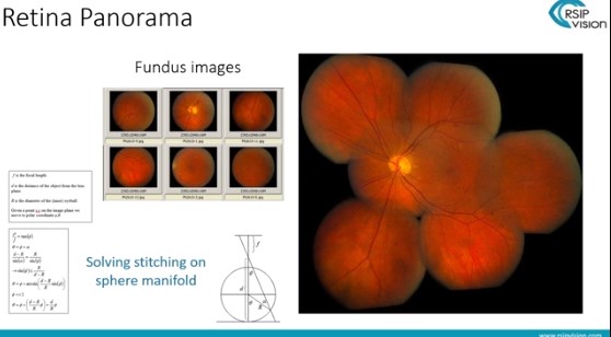 AI in Ophthalmology a webinar by RSIP Vision