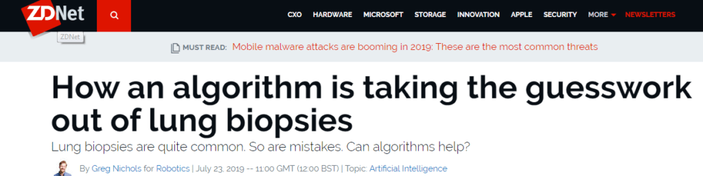 Lung Segmentation with Unmatched Precision for Lung Procedures