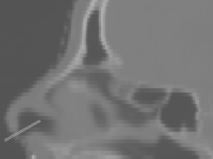 Learn more about RSIP Vision's AI solutions for ENT