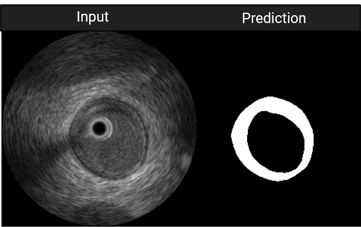 Cardiology Archives - RSIP Vision