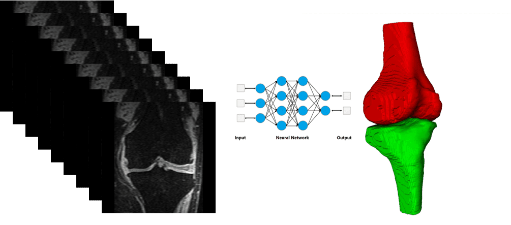 Orthopedics Archives - RSIP Vision