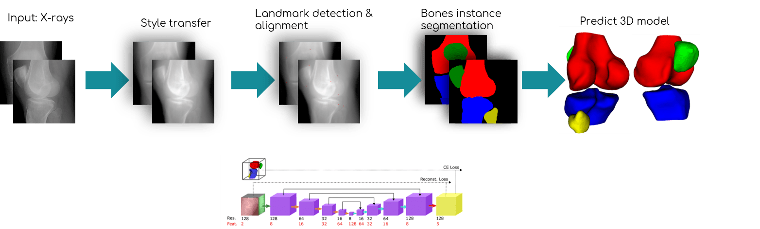 Orthopedics Archives - RSIP Vision