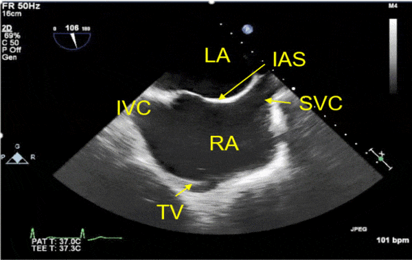 Ultrasound Archives - RSIP Vision