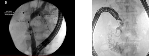 Endoscopy Archives - RSIP Vision