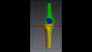 Medical segmentation Archives - RSIP Vision