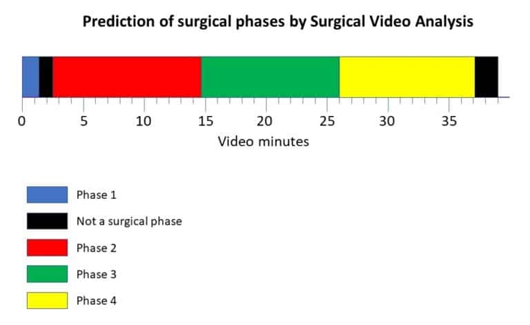 Best AI Algorithms for Surgical Video Analysis by RSIP Vision